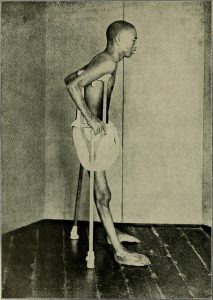 Micronutrients Matter: Thiamine (Vitamin B1) – Diets Debunked